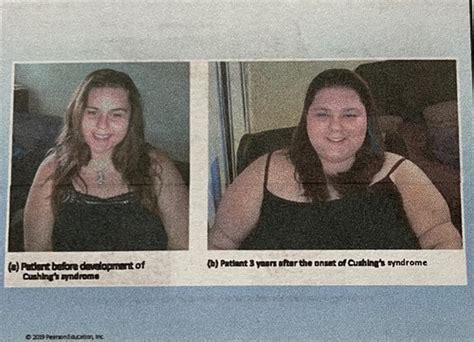 Ch 16 Flashcards Quizlet