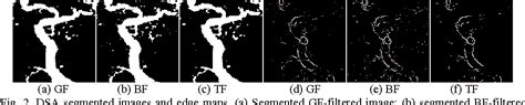 Figure 2 From A Nonlinear And Non Iterative Noise Reduction Technique