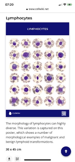 Lymphocytes Lymphocytes Lymphocytes Cll Support