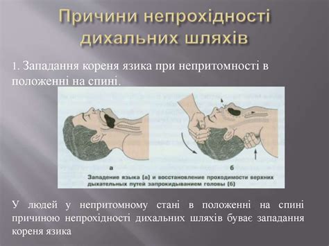 Причини порушення прохідності дихальних шляхів презентация онлайн