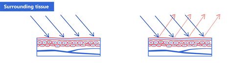 Principle Of Vein Finder 2 Vein Finder Vein Finder Review