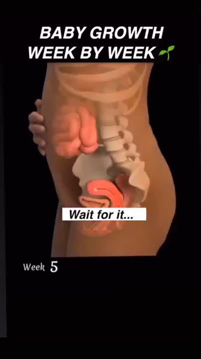 Shazmah Shaikh On Linkedin Pregnancy Newborn Obstetrics Obstetrician