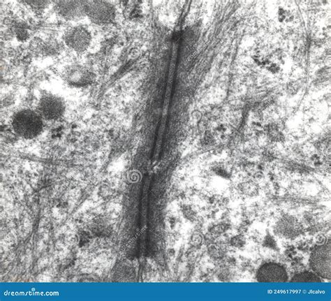 Desmosome Tem Micrograph Stock Image Image Of Transmission 249617997