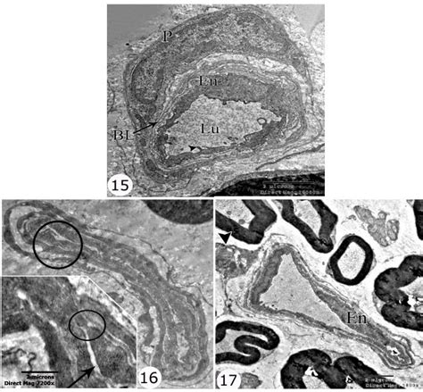 Cross Section Of An Endoneurial Blood Capillary Lined By Continuous