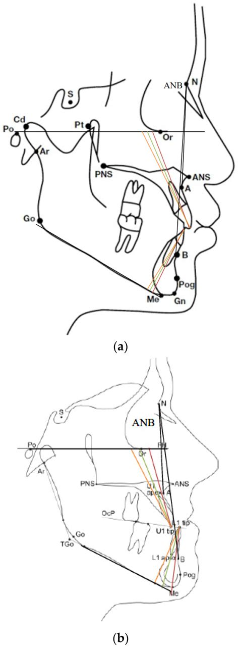 Comparative Assessment Of Perception About Angle Inclination Of