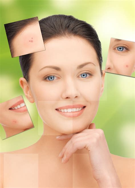 How To Get Rid Of Pigmentation On Nose Its Definitely Annoying But
