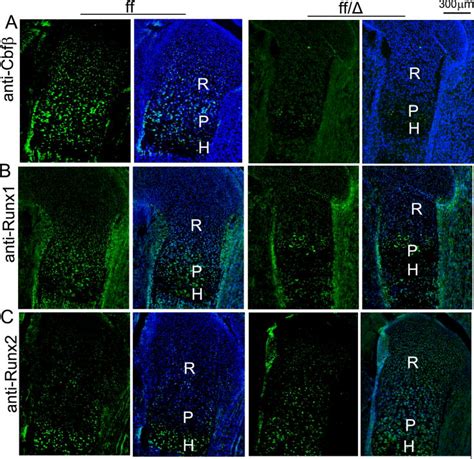 Deletion Of Core Binding Factor β Cbfβ In Mesenchymal Progenitor