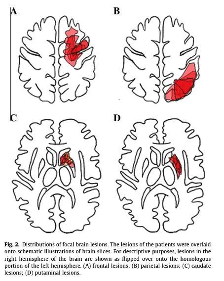 Saccade Ifcn And Its Clinical Neurophysiology Journals