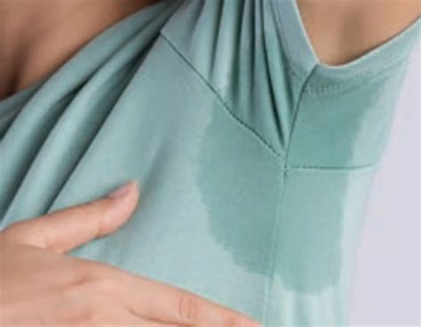Understanding Axillary Hyperhidrosis Doctoram Clinics