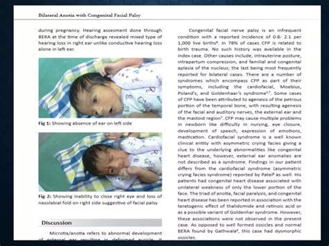 approach to a newborn with multiple congenital anomaly pptx