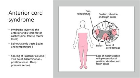 Sci Classification Ppt