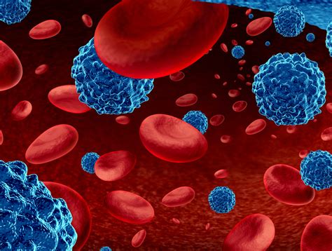 Multiple Myeloma Side Effects Peoplebeatingcancer