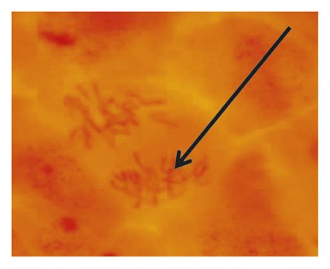 Allium Cepa Root Tip Cells Grown In Tannery Effluent A Sticky