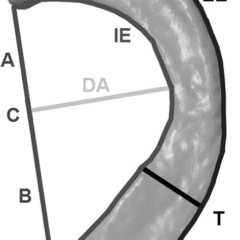 Inferior View Of The First Right Rib And Measurements Executed On This