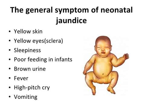 Jaundice Symptoms In Newborns 5 Easy Jaundice Test For Early Diagnosis