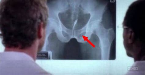 ปลาแคนดิรู 1 ใน 10 ปลาอันตรายที่สุดในโลก ชอบจู่โจมงูน้อยของมนุษย์