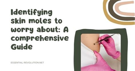 Identifying Skin Moles To Worry About A Comprehensive Guide