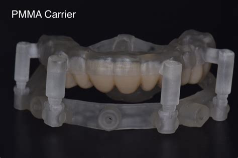 Stackable Surgical Guides Design Cadcam Masters