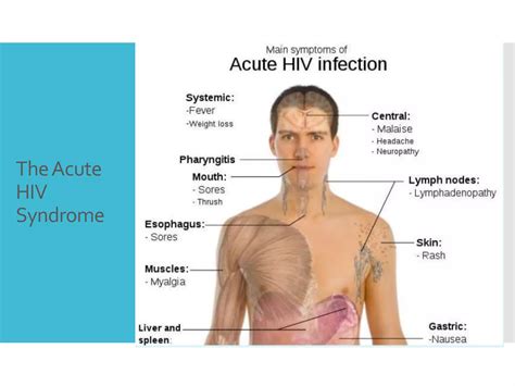 Hiv Aids Ppt