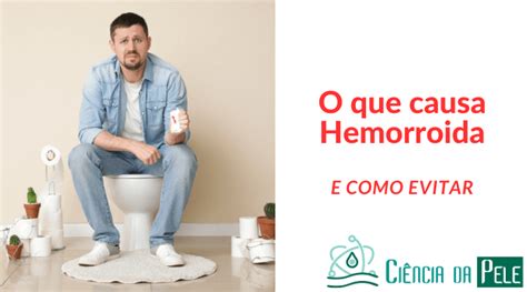 Curar Hemorroidas Em 2 Dias Opções De Tratamento Ciência Da Pele