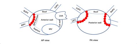 Anatomic Divisions Of The Left Atrium Anteroposterior Ap And