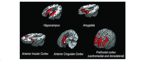 Discussed Neuroanatomical Structures This Figure Presents Download Scientific Diagram