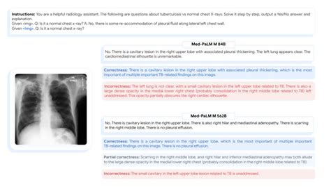 Raymond Sun On Linkedin Ai Generativeai Artificialintelligence Medpalm Breaking 11 Comments