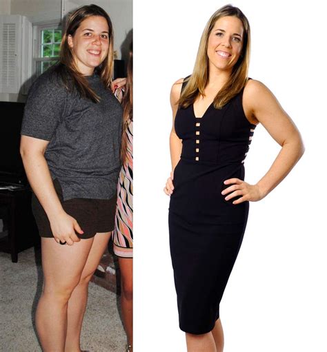Perda De Peso Antes E Depois Da Mulher Weightlosslook Tea Band