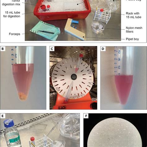 Supernatant Collection And Pdtf Digestion Into Single Cell Suspensions