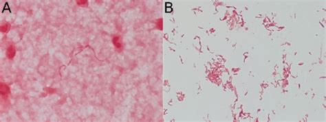 A Flagella Like Gram Negative Streptobacillus Moniliformisrods In Download Scientific Diagram