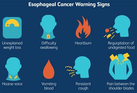 Esophageal Cancer Oncology