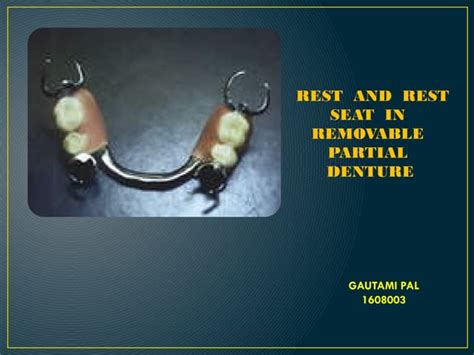 Rests And Rest Seats In Removable Partial Dentures Ppt