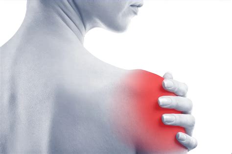 Calcific Tendonitis London Sports Orthopaedics