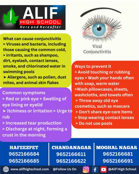 7 Effective Ways To Prevent Conjunctivitis Blog Alif High School