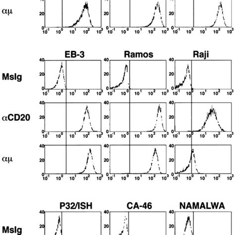 Expression Of Cd20 And B Cell Antigen Receptor In Burkitts