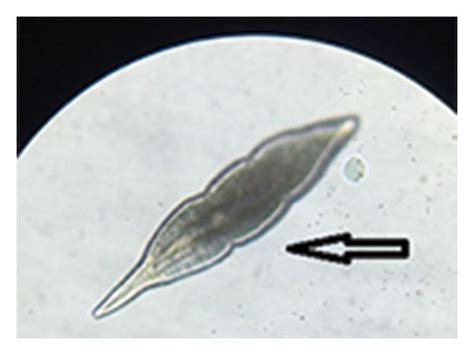 Dactylogyrus Spp Black Arrow Isolated From Gills Of Tilapia Download Scientific Diagram