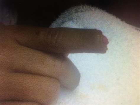 Right Pointer Finger Ramputee