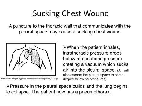Ppt Soft Tissue Injury Powerpoint Presentation Free Download Id