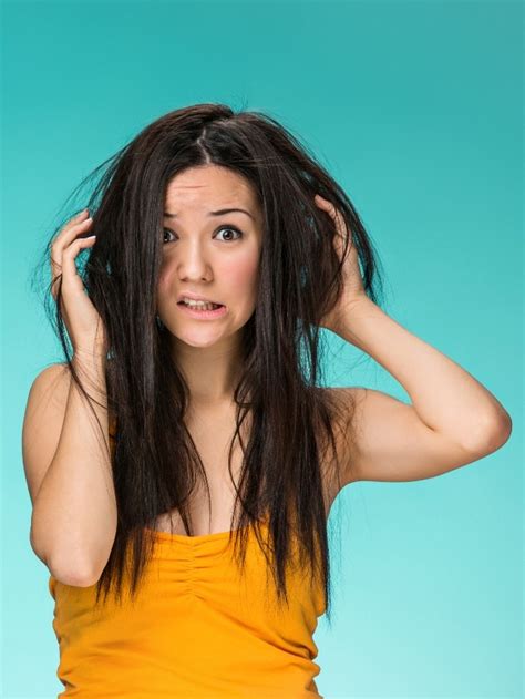 Ways To Deal With Dry Scalp In Winter Healthshots
