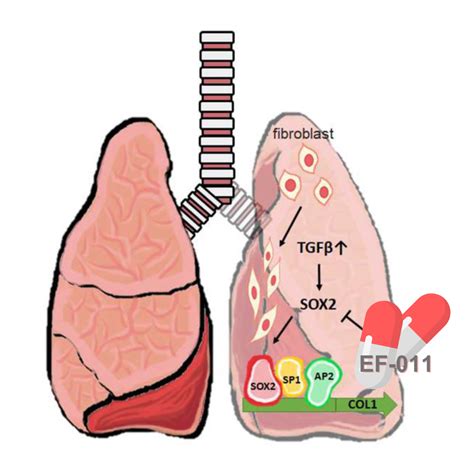 Ef 011 Idiopathic Pulmonary Fibrosis Treatment Everfront Biotech