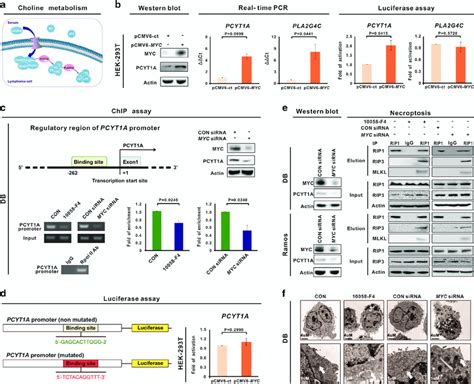 Myc Acted On Lymphoma Choline Metabolism By Regulating Pcyt1a