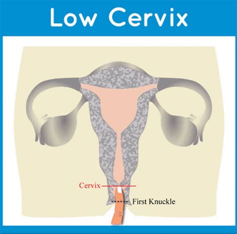 Best Menstrual Cups For Low High Cervix How To Measure It