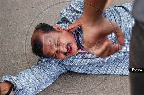 Image Of A Man Beaten By Another Man Bleeding Closeup Gv174731 Picxy