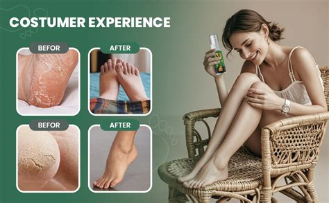 7 Days Ginger Foot Spray Odor Control And Callus Care