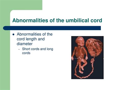 Ppt Single Umbilical Artery Powerpoint Presentation Id774207