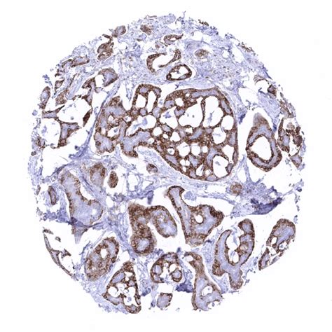 Cancer Tissue Gallery Gtx04373 Genetex