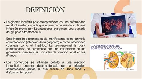 Solution Glomerulonefritis Post Streptococica Studypool