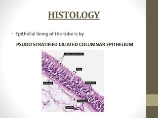 Eustachian Tube Pptx