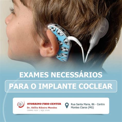 Exames Necessários Para O Implante Coclear Otorrino Fisio Center