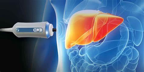 Fibroscan In Ahmedabad Advanced Liver Diagnostics At Omegaendo